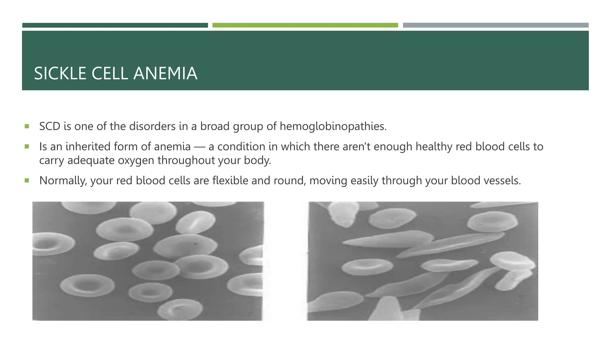 pediatrics 6. Sickle Cell Anemia 6.1.pptx