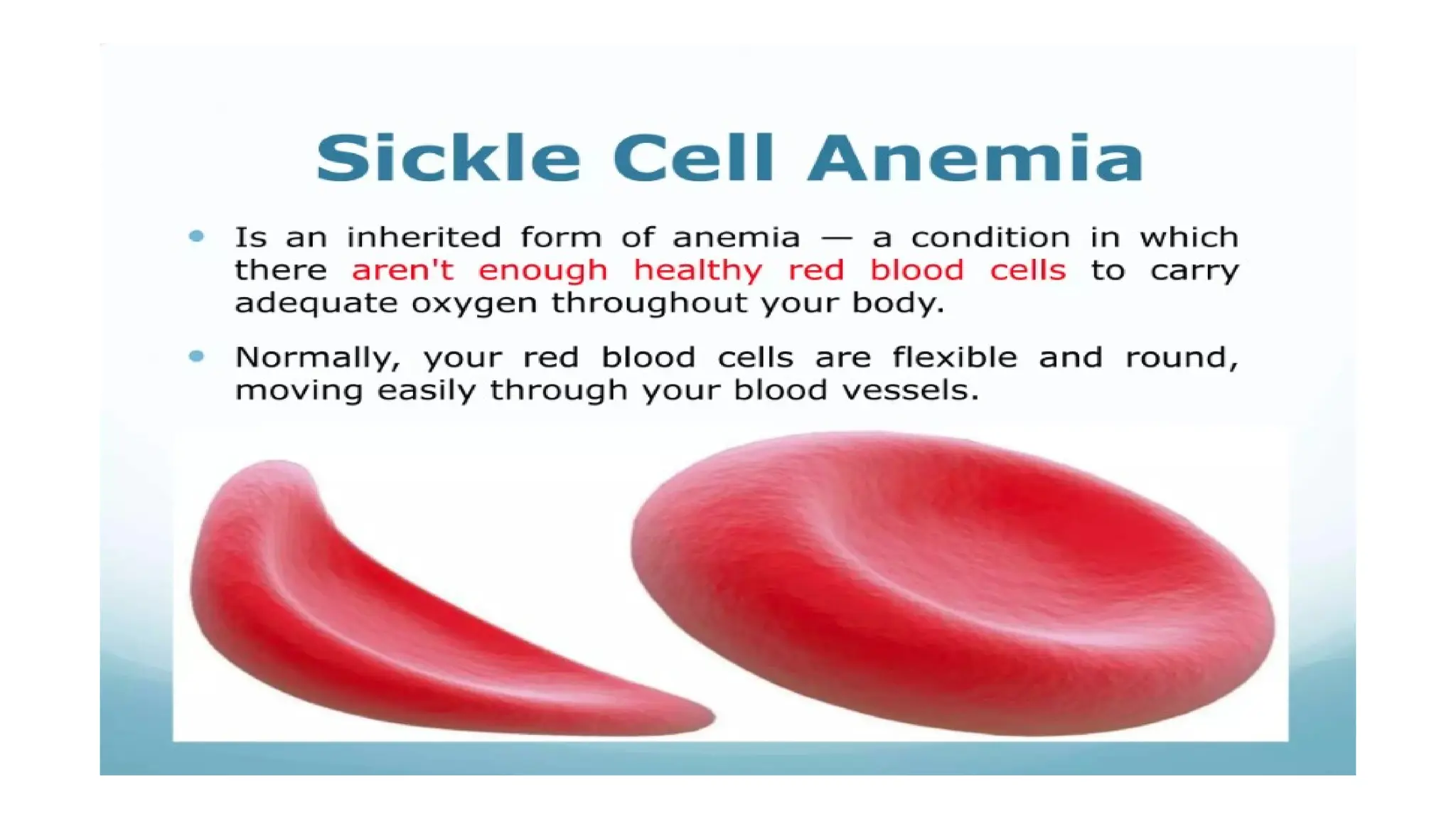 sickle cell anemia disease.pptx anemia disorder | PPTX