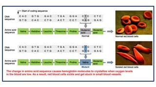 Sickle cell anemia final | PDF