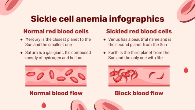 Sickle Cell Anemia Infographics by Slidesgo.pptx | Space and Astronomy ...
