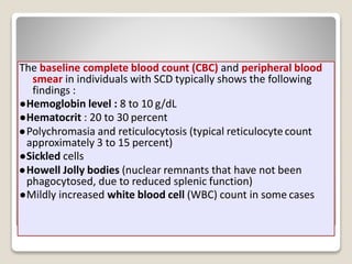 sickle cell anemia | PPTX