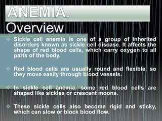 SICKLE CELL ANEMIA PPTX.pptx