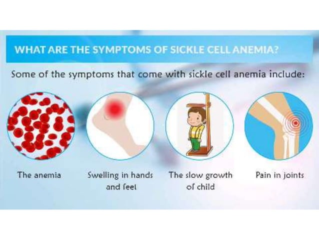 Sickle Cell Anemia: Treatment, Diagnosis, Cost, Success & Survival Rate ...