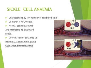 Sickle cell disease | PPTX