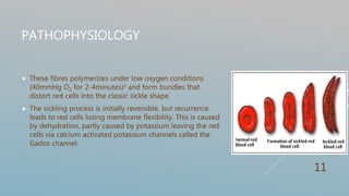 Sickle cell disease | PPTX | Blood Disorders | Diseases and Conditions