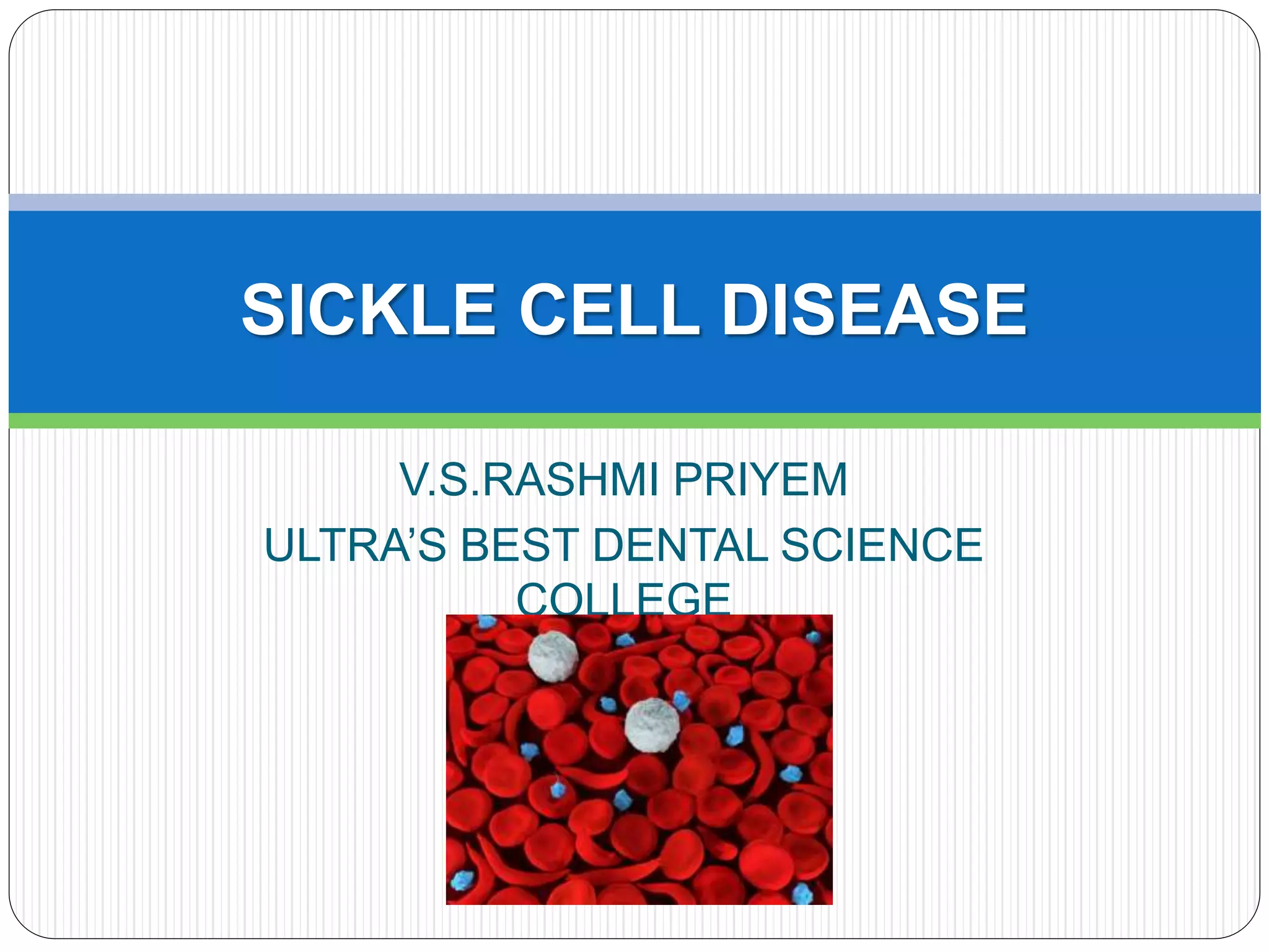 Sickle Cell Disease Ppt