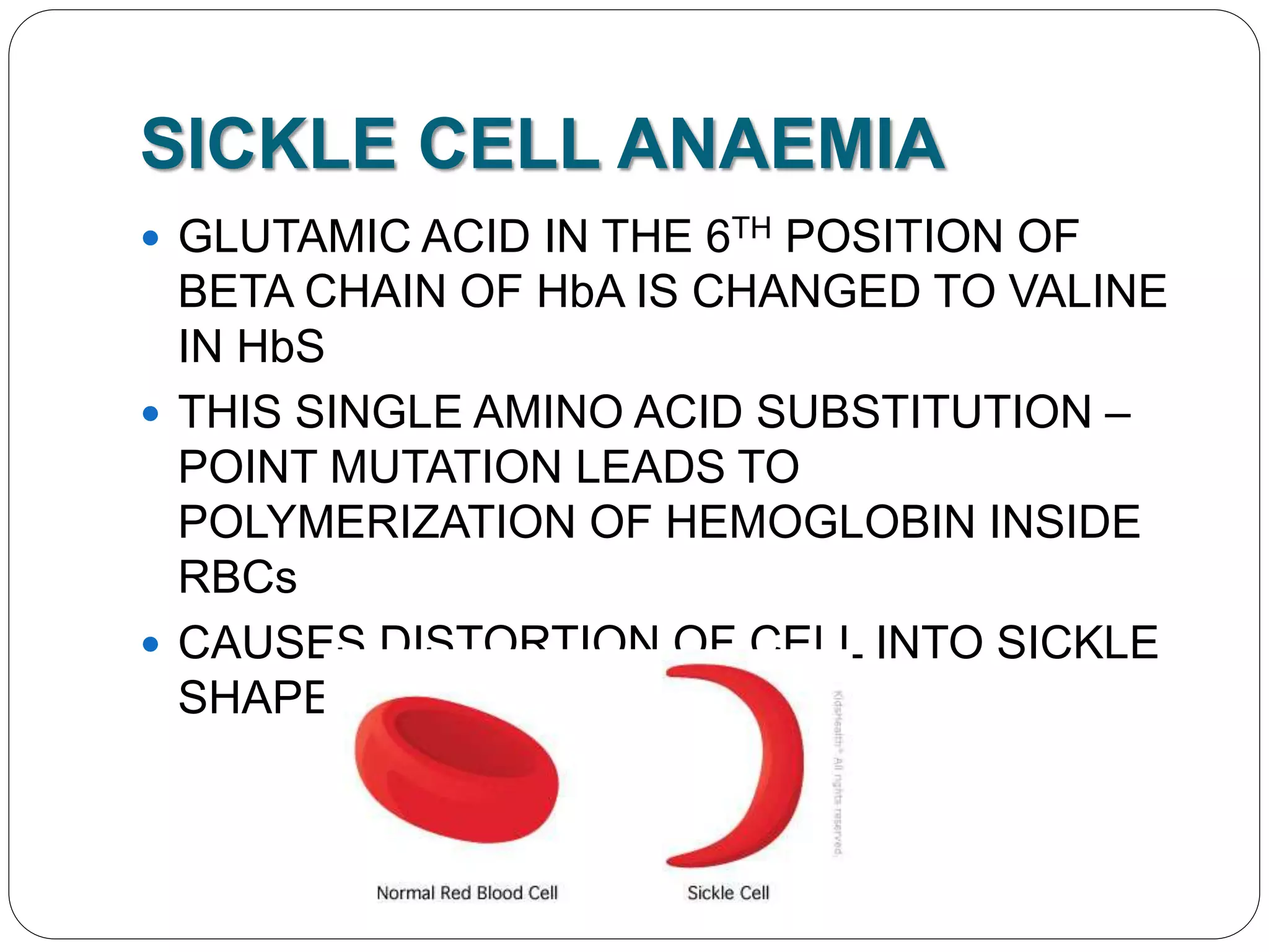 Sickle Cell Disease | PPTX