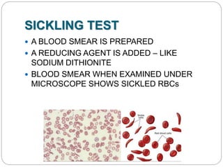 Sickle Cell Disease | PPT