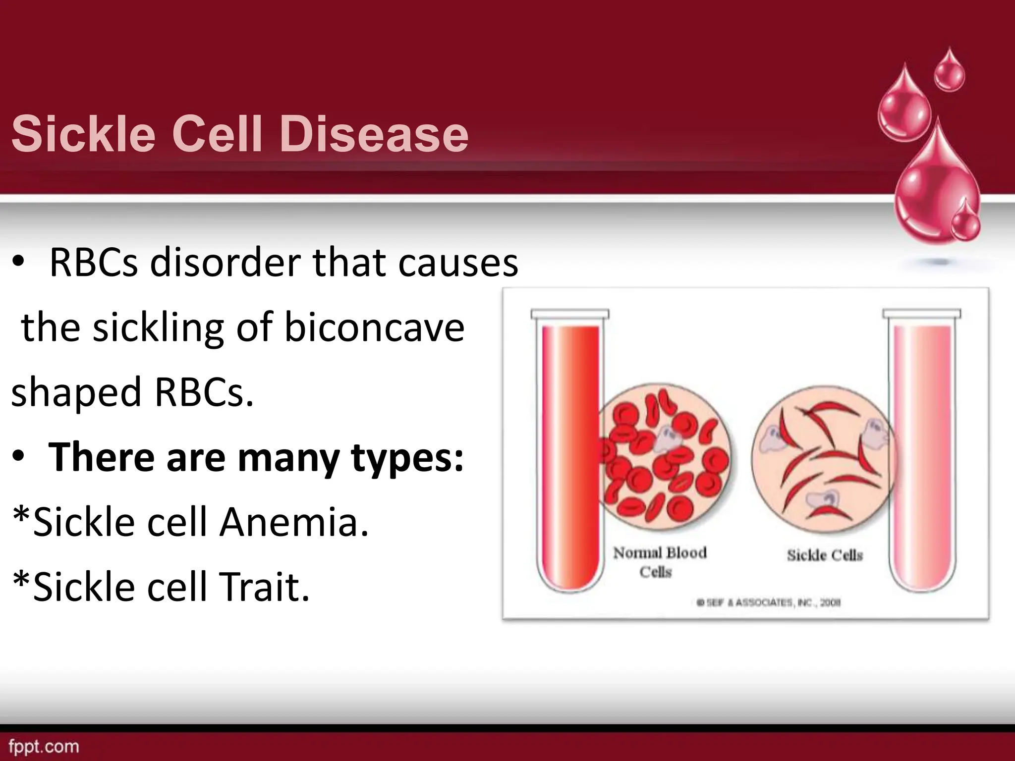 sicklecelldisease.pptx by doctor Asif zeb | PPT