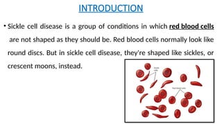 sickle cell disease in children .pptx