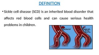sickle cell disease in children .pptx