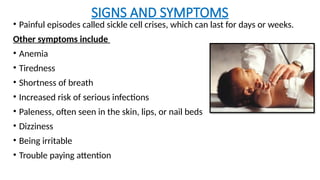 sickle cell disease in children .pptx
