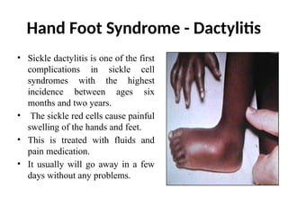 Sickle cell diseaseODAFDKLSFKLDSAJFKL;DSAJFKLSDJFKL;DSJFKLSDJFSAK | PPT