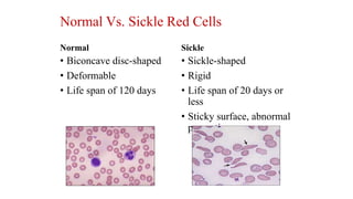 Sickle Cell Disease - Obuasi.pptx