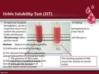 Sickle cell disease | PPT