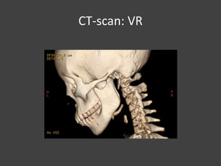 Sickle cell disease (bone changes)_Torfs | PPTX