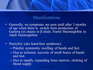 Sickle cell disease | PDF