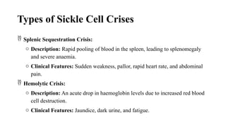 Presentation on Sickle Cell Disease Crises_090424.pptx