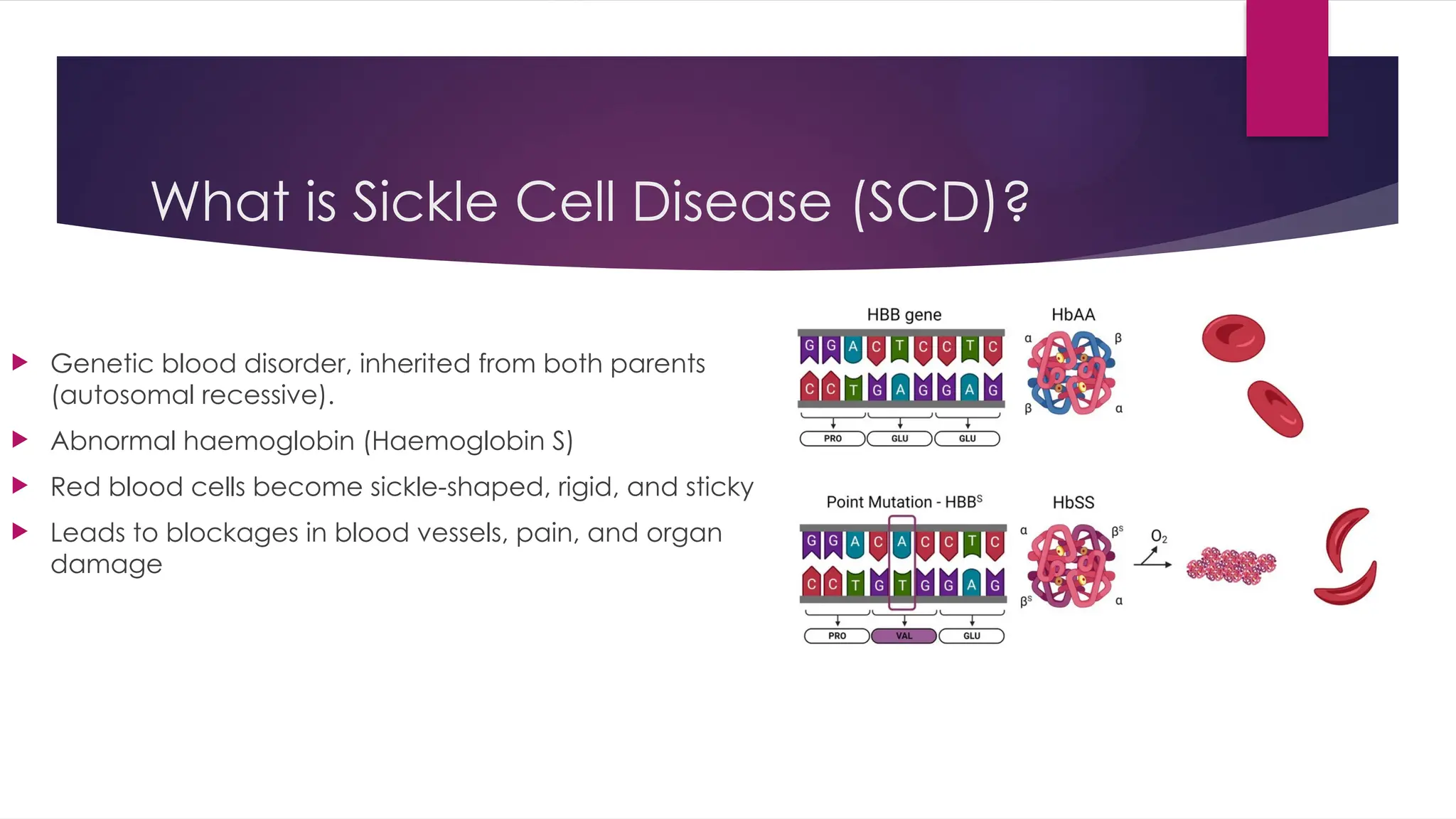 Sickle cell disease; Dr Dibyajyoti Prusty.pptx