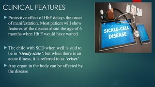 Sickle cell disease in children and management.pptx