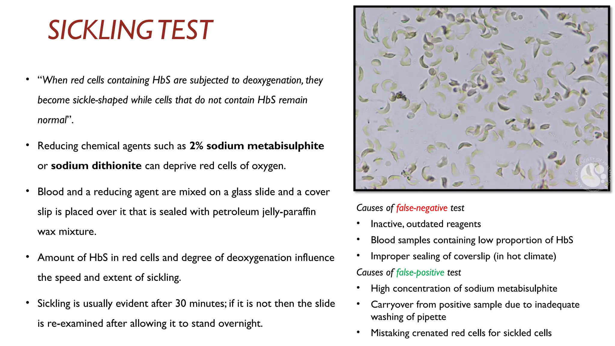 APPROACH TO DIAGNOSIS OF SICKLE CELL DISORDERS.pptx