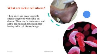 sickle cell leg ulcer.pptx
