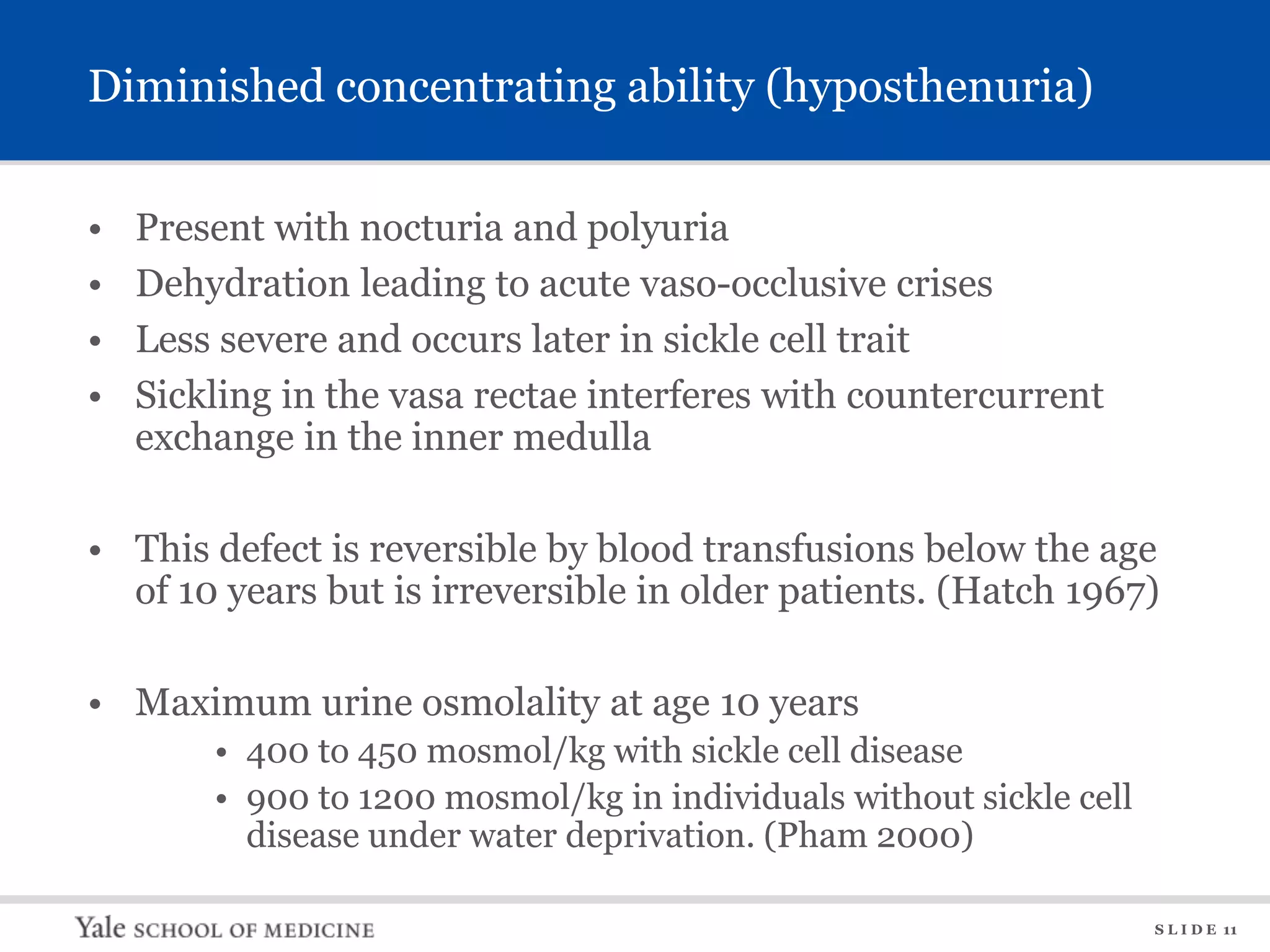 Sickle Cell Nephropathy.pptx