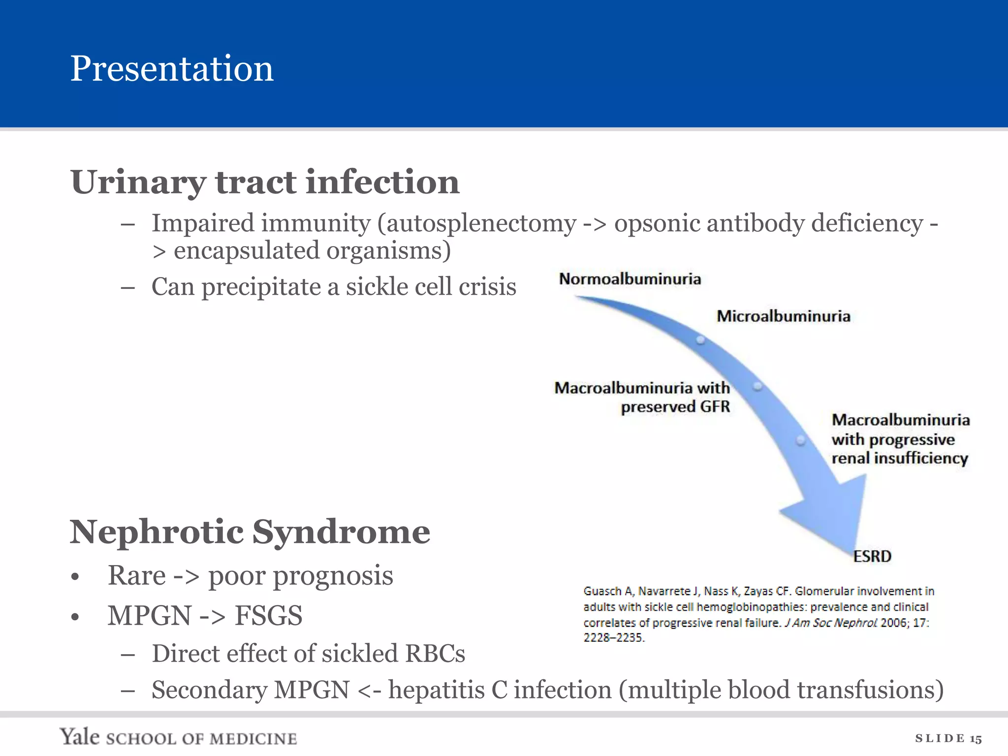 Sickle Cell Nephropathy.pptx