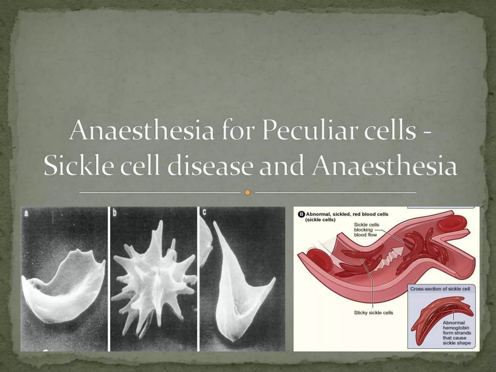Sickle cell ppt | PPTX | Blood Disorders | Diseases and Conditions