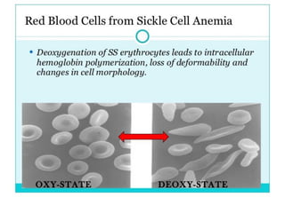 SICKLE CELL PPT 01.pdf