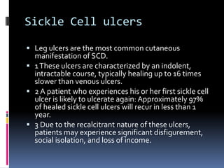 Sickle_Cell_Ulcers.pptx