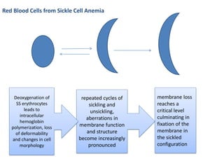 Comprehensive Overview of Sickle Cell Disease and Immune Hemolytic ...