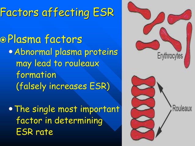 methods used for testing sickling test .ppt