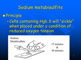 methods used for testing sickling test .ppt