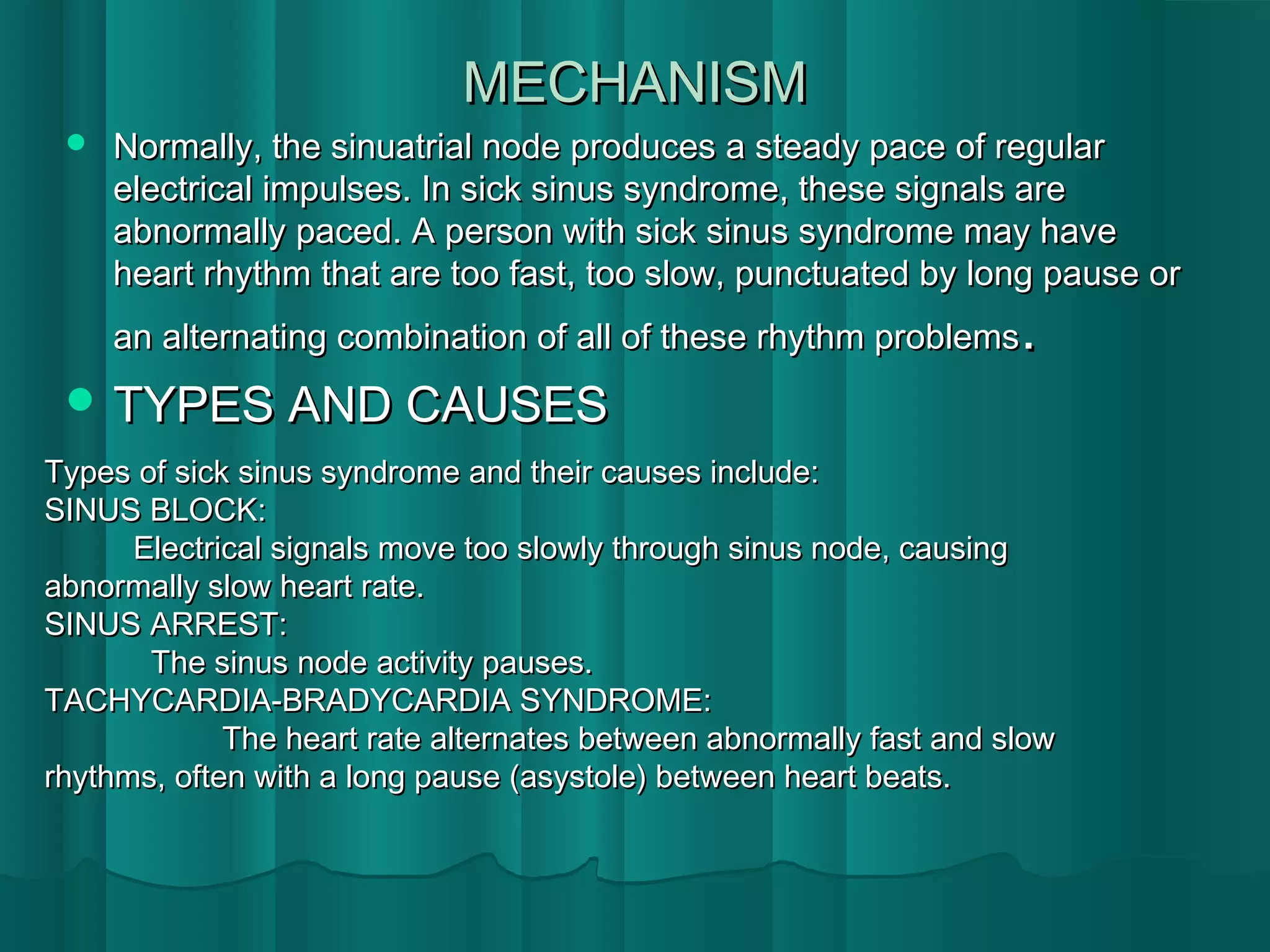 Sick sinus syndrome-2 | PPT