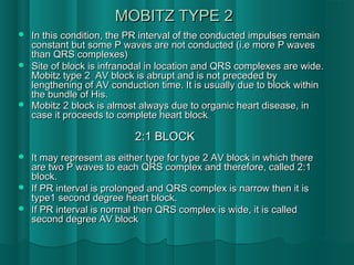 Sick sinus syndrome-2 | PPT