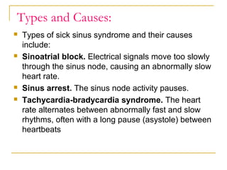 Sick sinus syndrome | PPT