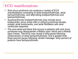 Sick sinus syndrome | PPT