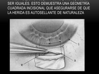 Sics 1 construccion de herida sics español | PPTX