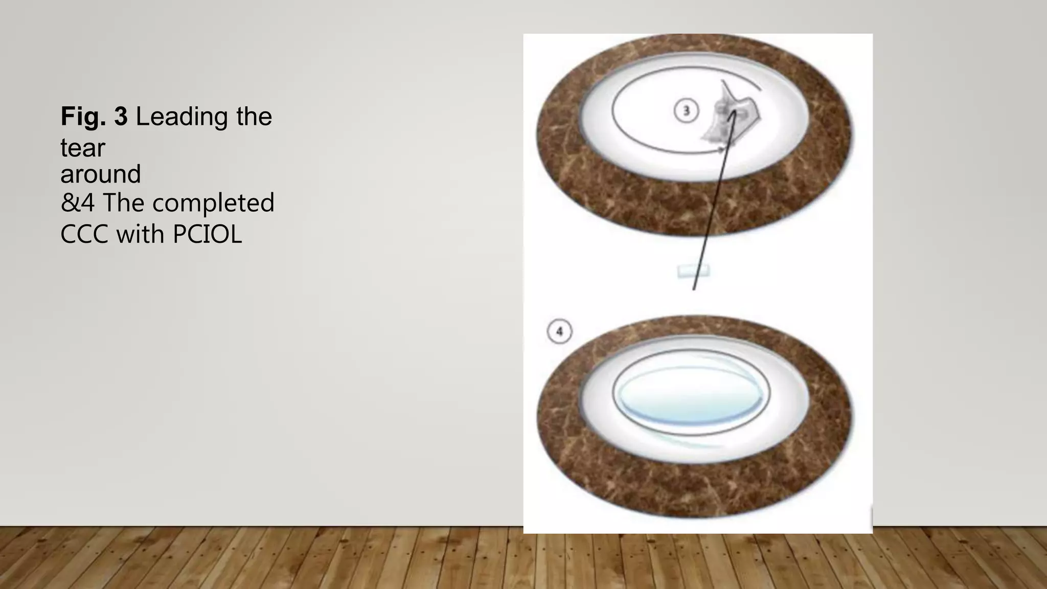 Sics steps | PPTX