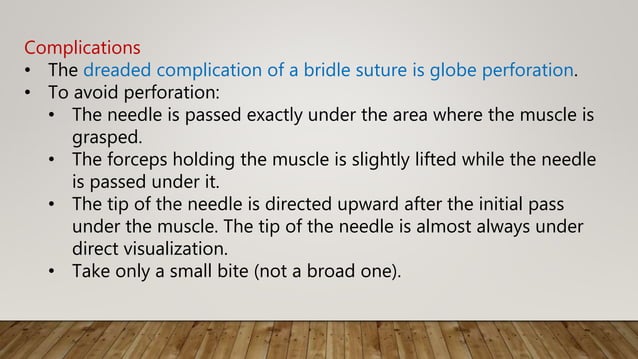 Sics steps | PPTX | Eye and Vision Conditions | Diseases and Conditions