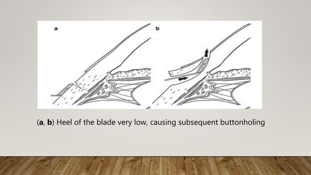 Sics steps | PPTX | Eye and Vision Conditions | Diseases and Conditions