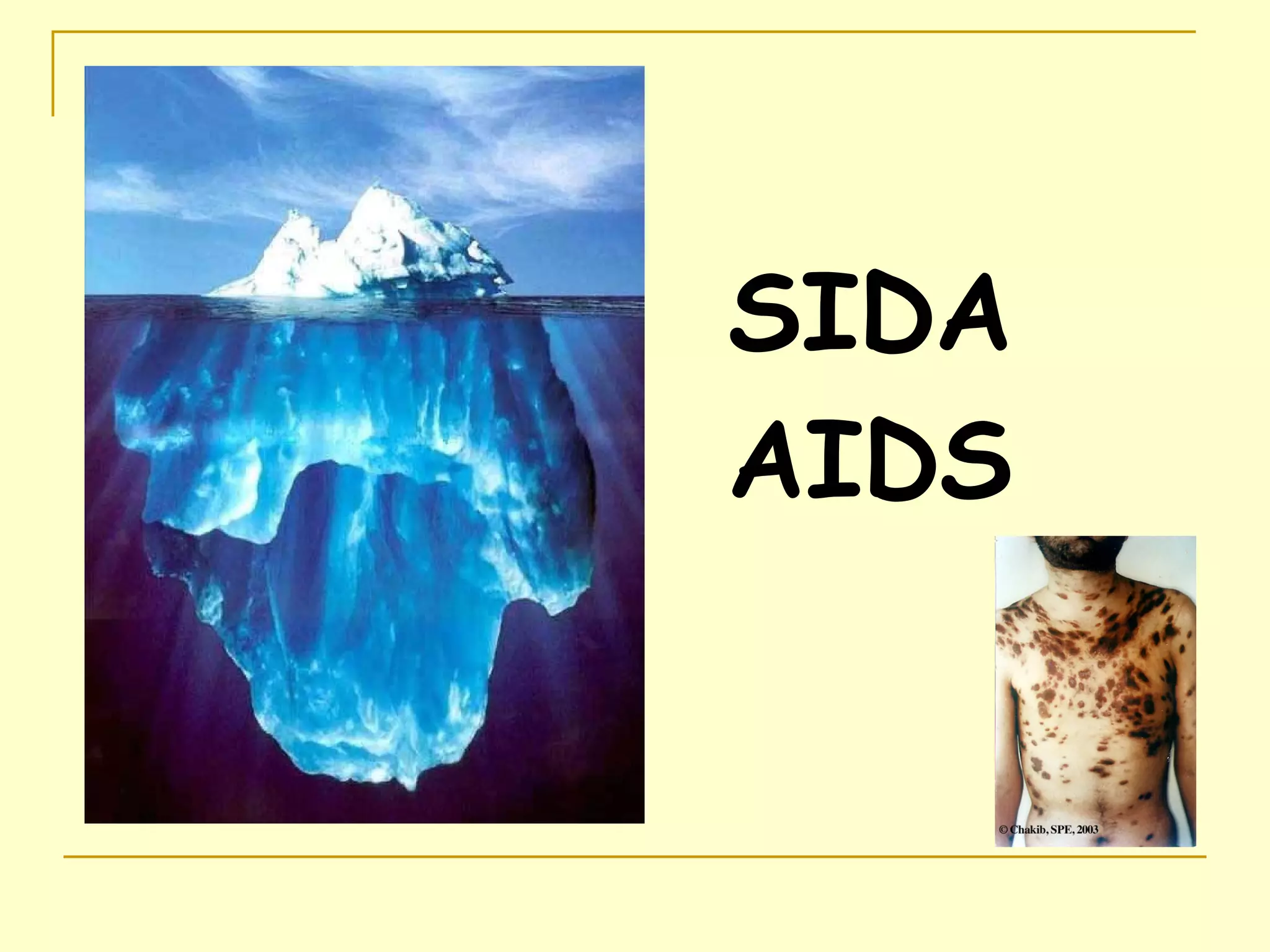 SIDA | PPT