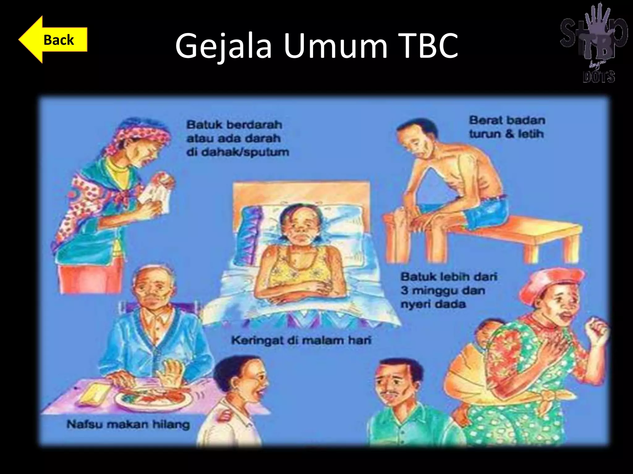 Tuberkulosis (TBC) dengan program DOTS | PPTX