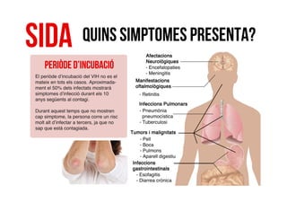 SIDA | PDF