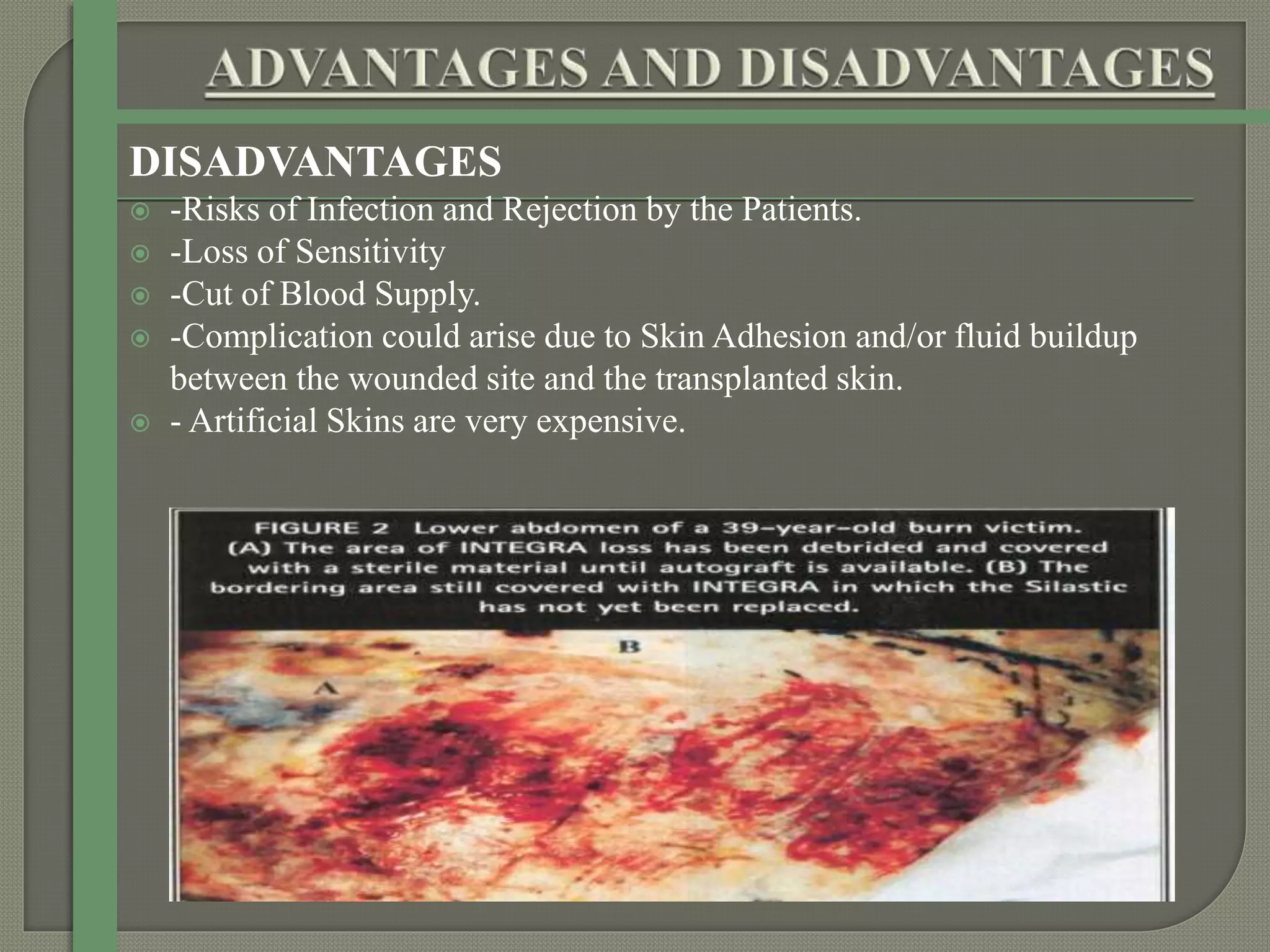 artificial skin technique | PPTX
