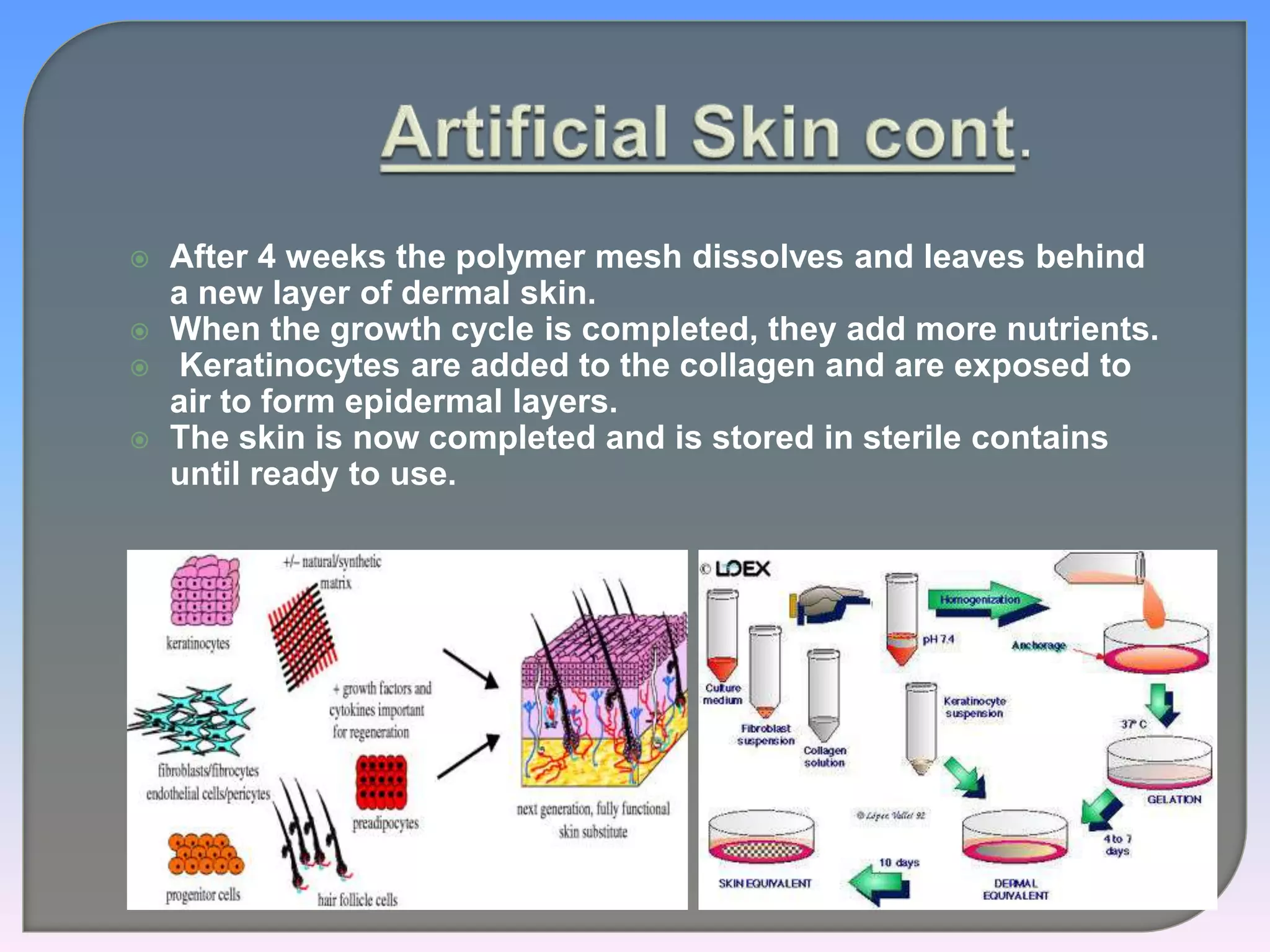 artificial skin technique | PPTX