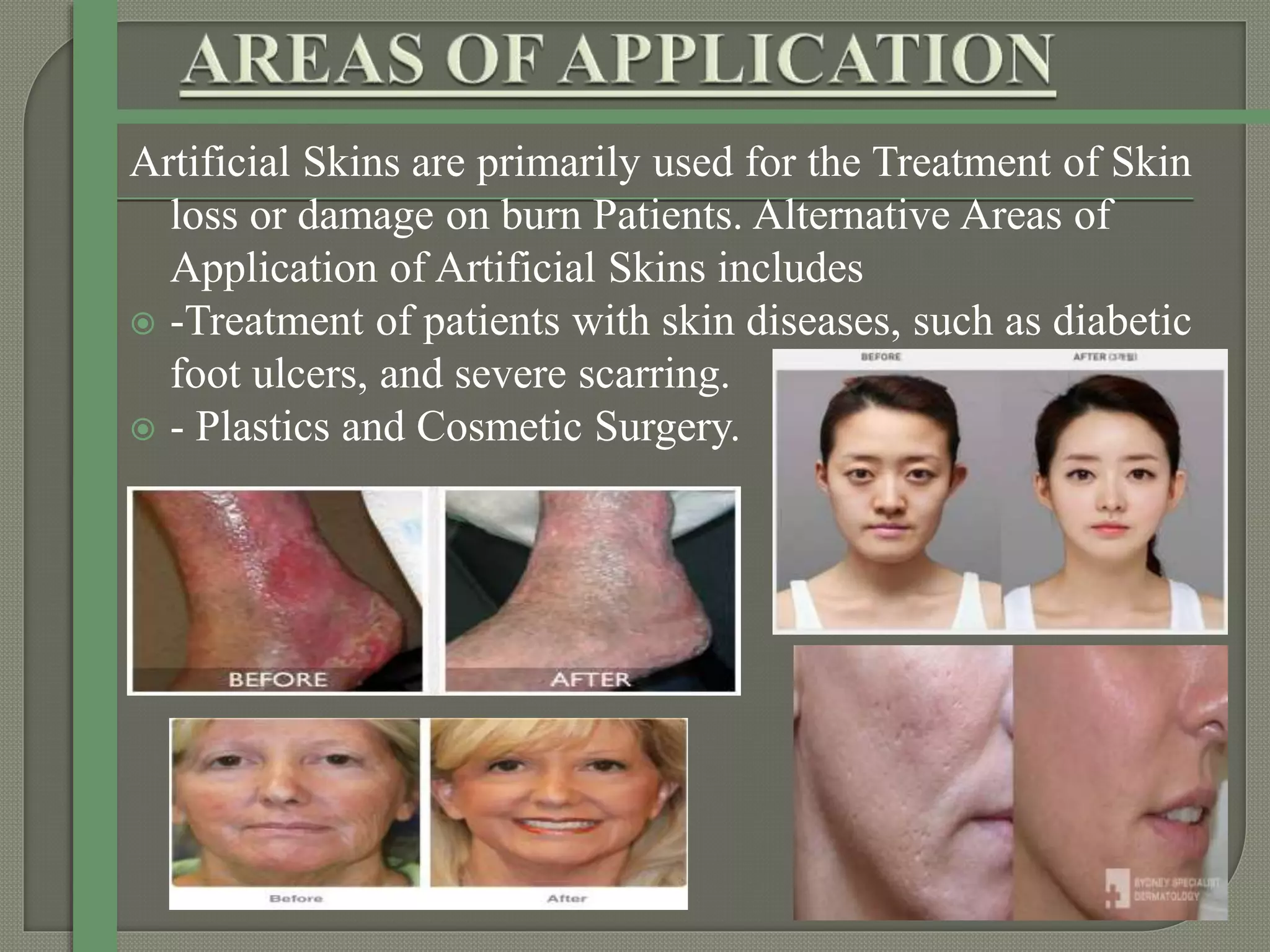 artificial skin technique | PPTX