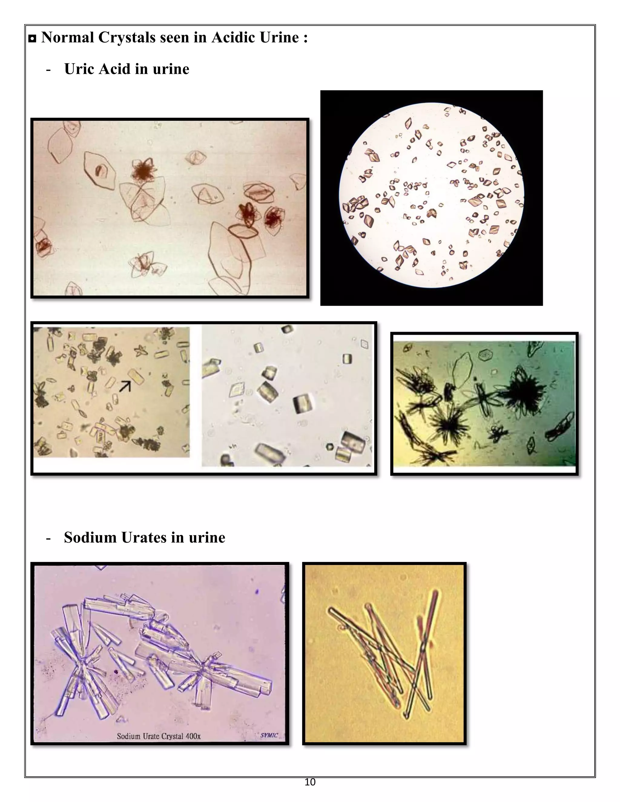 Urine analysis & Hematology Slides | PDF