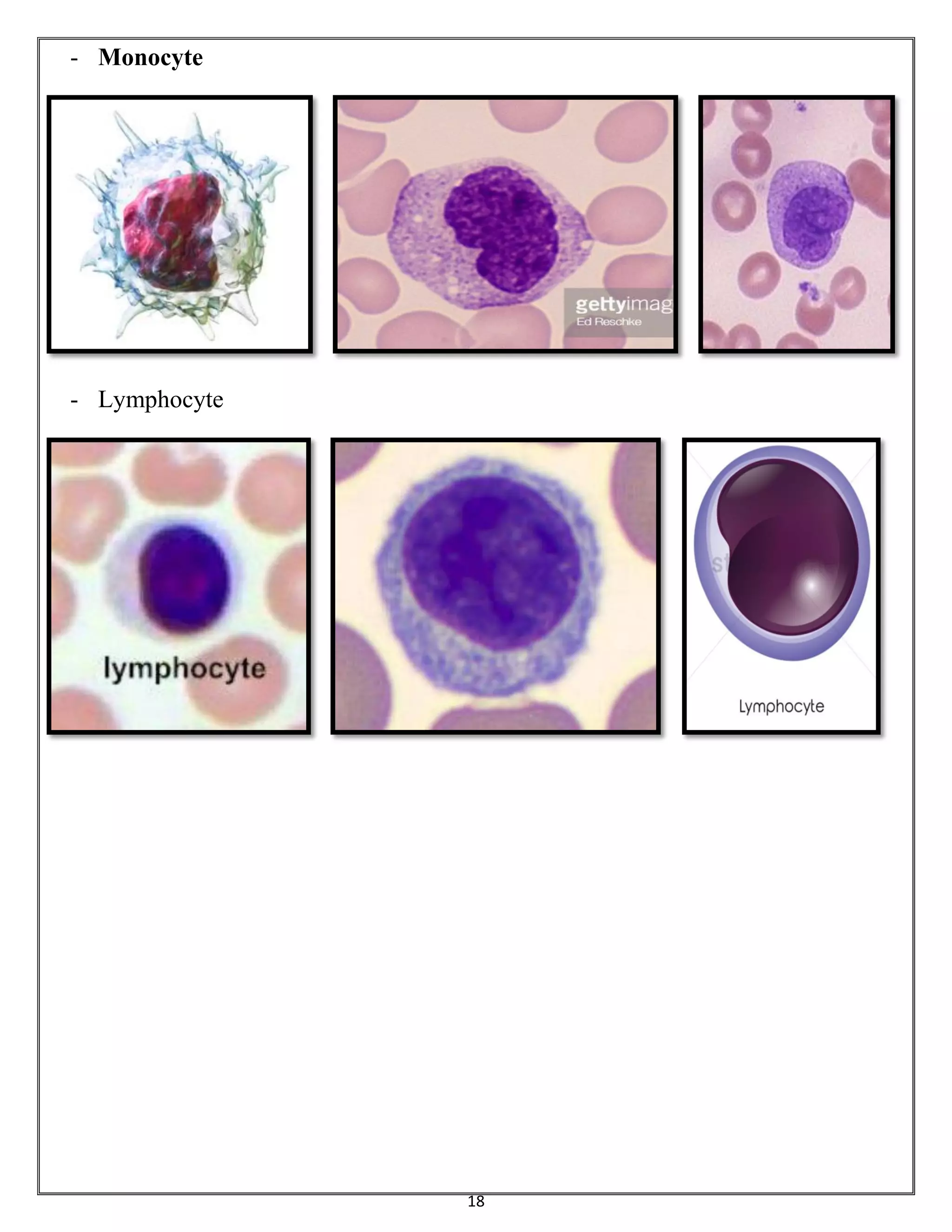 Urine analysis & Hematology Slides | PDF